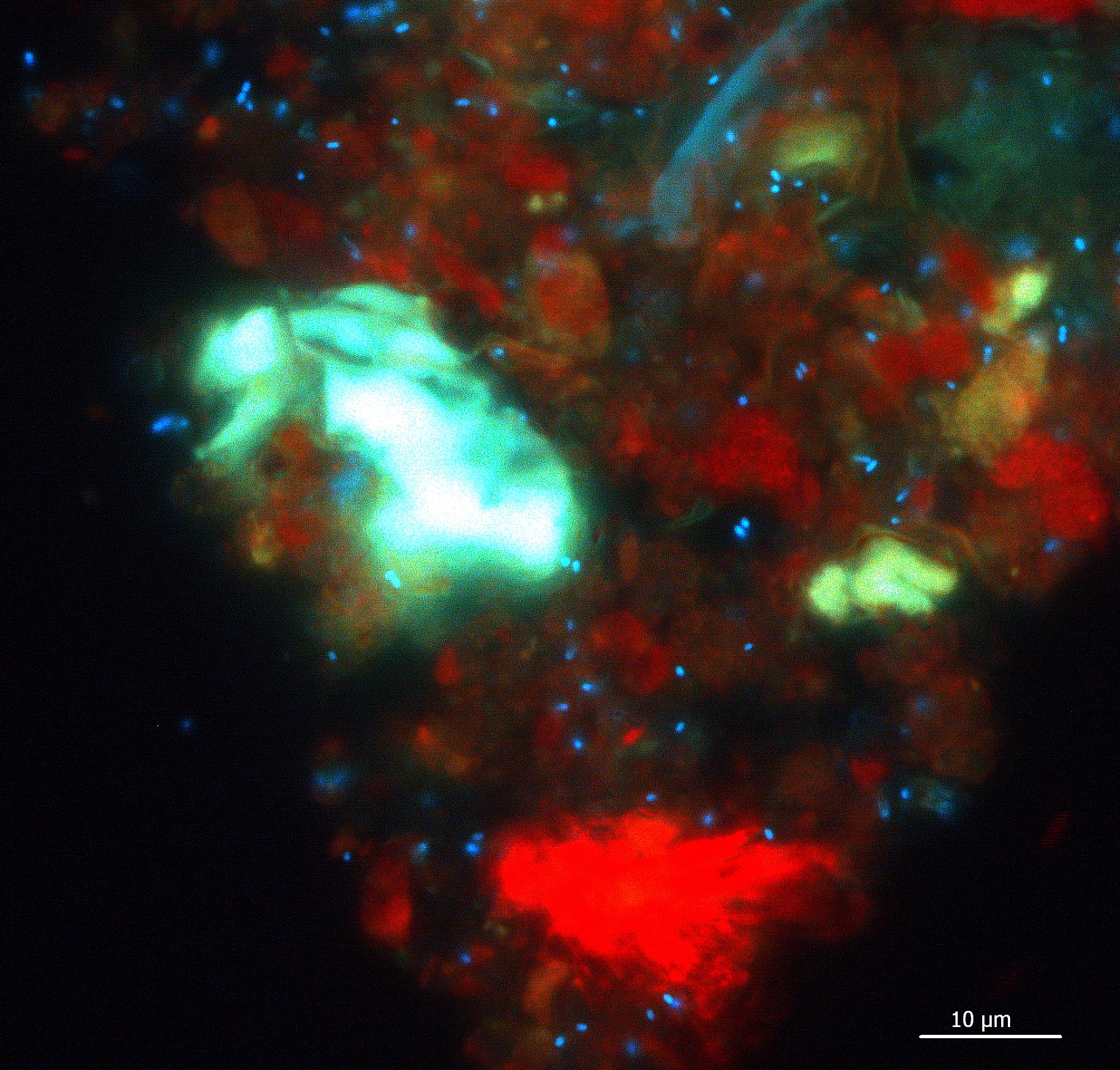 Global Rumen Census | Global Research Alliance